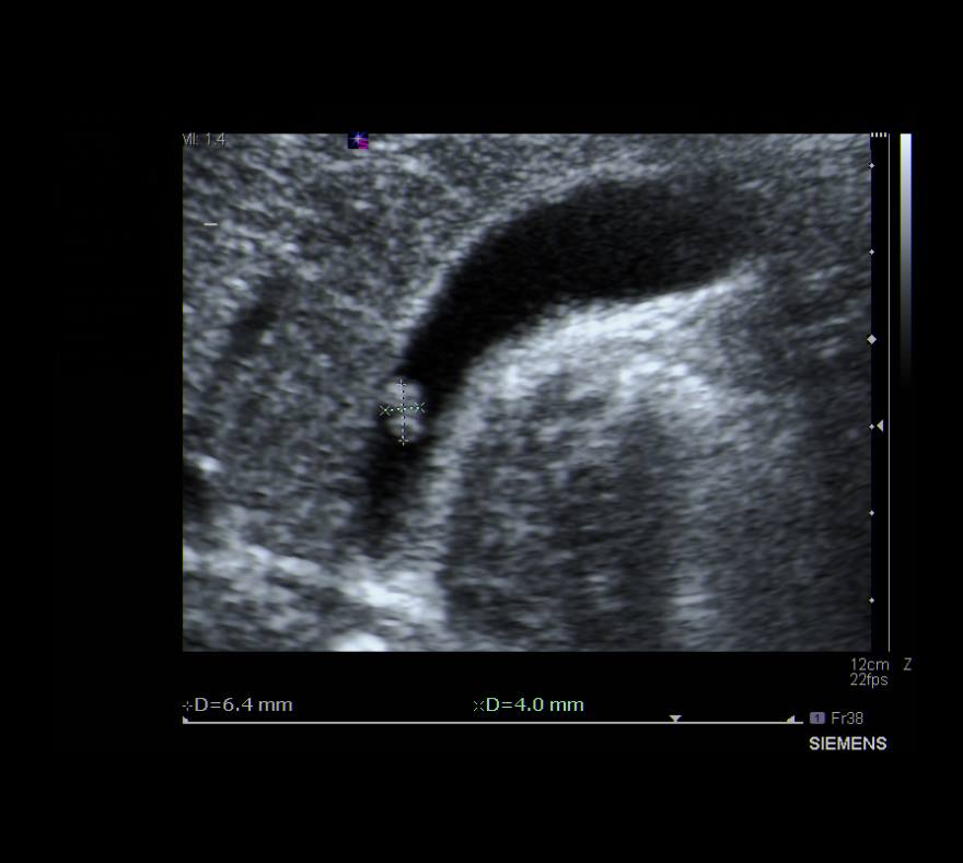 Gastroenterologija | Gastroskopija | Kolonoskopija | Ultrazvuk abdomena