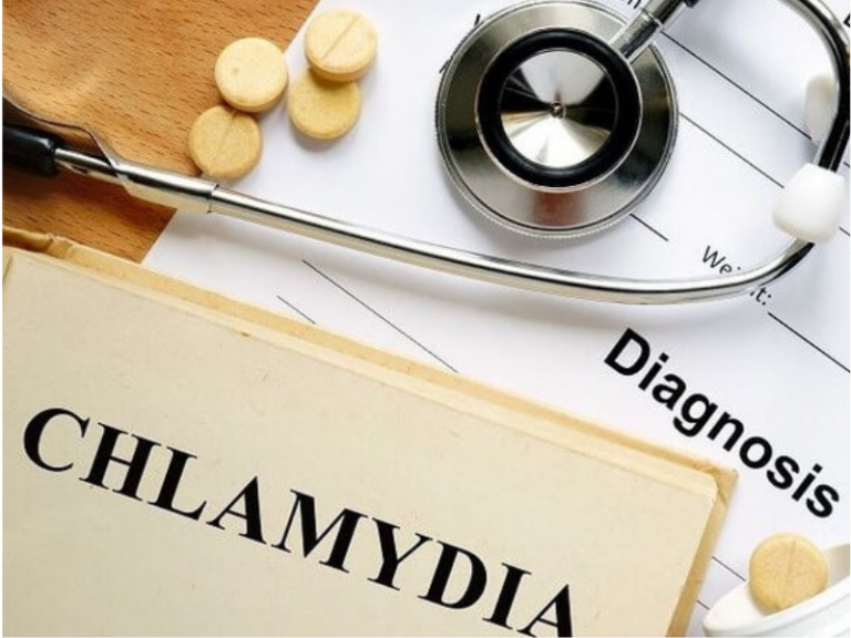 Što je klamidija, koji su simptomi i kako se liječi? - Poliklinika Fleur