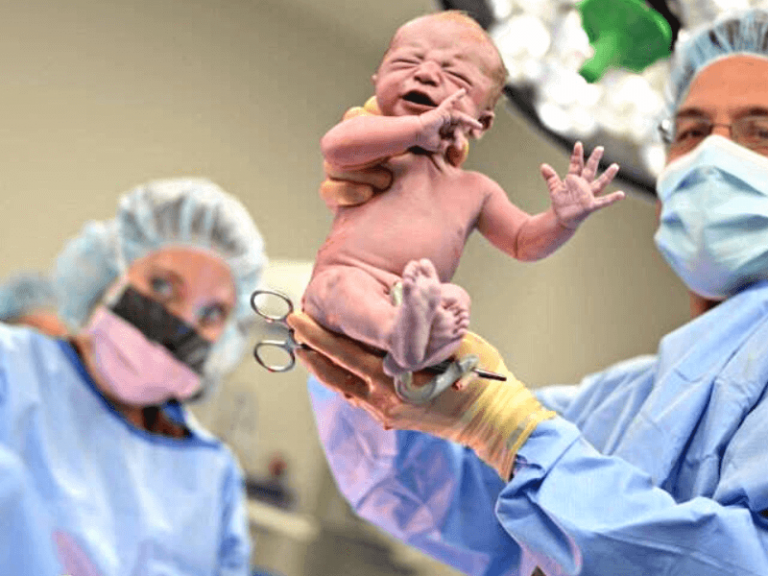 Prirodni porod ili carski rez? - Poliklinika Fleur